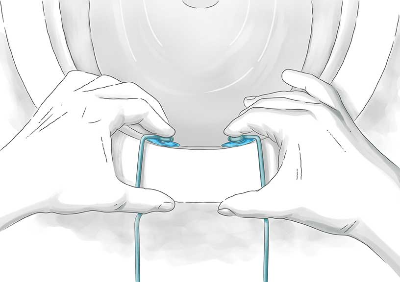 How It Works - Ostomy Aid